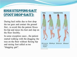Abnormal gait by SURYA LIKHITA-VAPMS COLLEGE OF PHYSIOTHERAPY | PDF