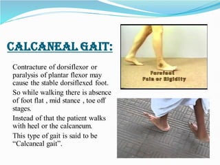 Abnormal gait by SURYA LIKHITA-VAPMS COLLEGE OF PHYSIOTHERAPY | PDF