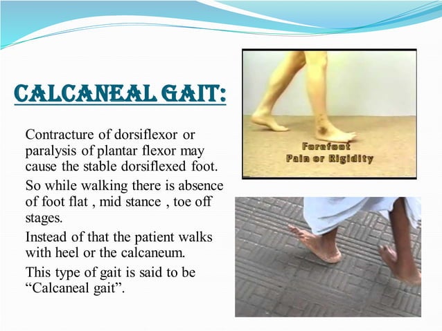 Abnormal gait by SURYA LIKHITA-VAPMS COLLEGE OF PHYSIOTHERAPY | PDF ...