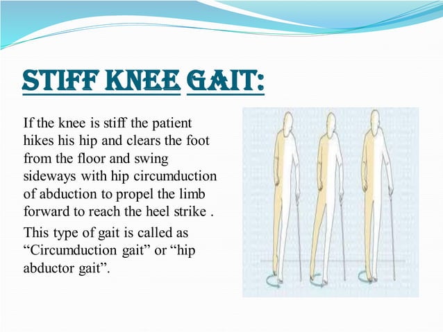 Abnormal gait by SURYA LIKHITA-VAPMS COLLEGE OF PHYSIOTHERAPY | PDF ...