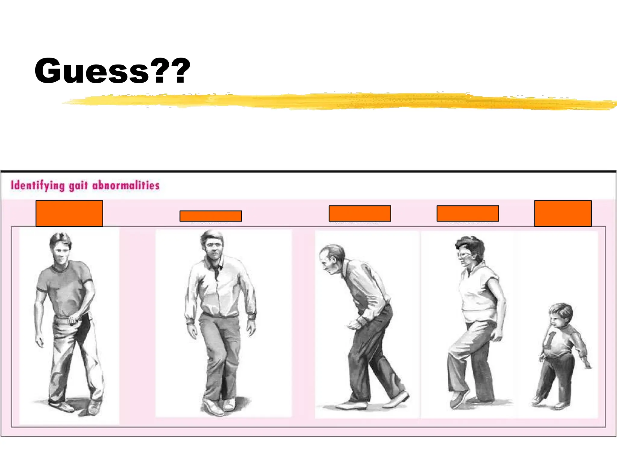 Abnormal gait.ppt.......................... | PPT