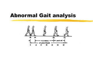 Abnormal gait.ppt.......................... | PPT
