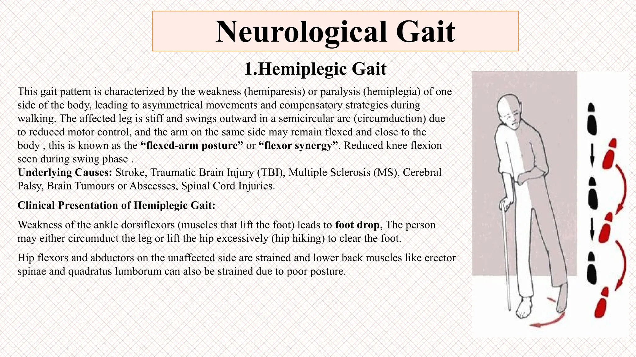 Abnormal Gait Pattern :Types and Causes. | PPTX