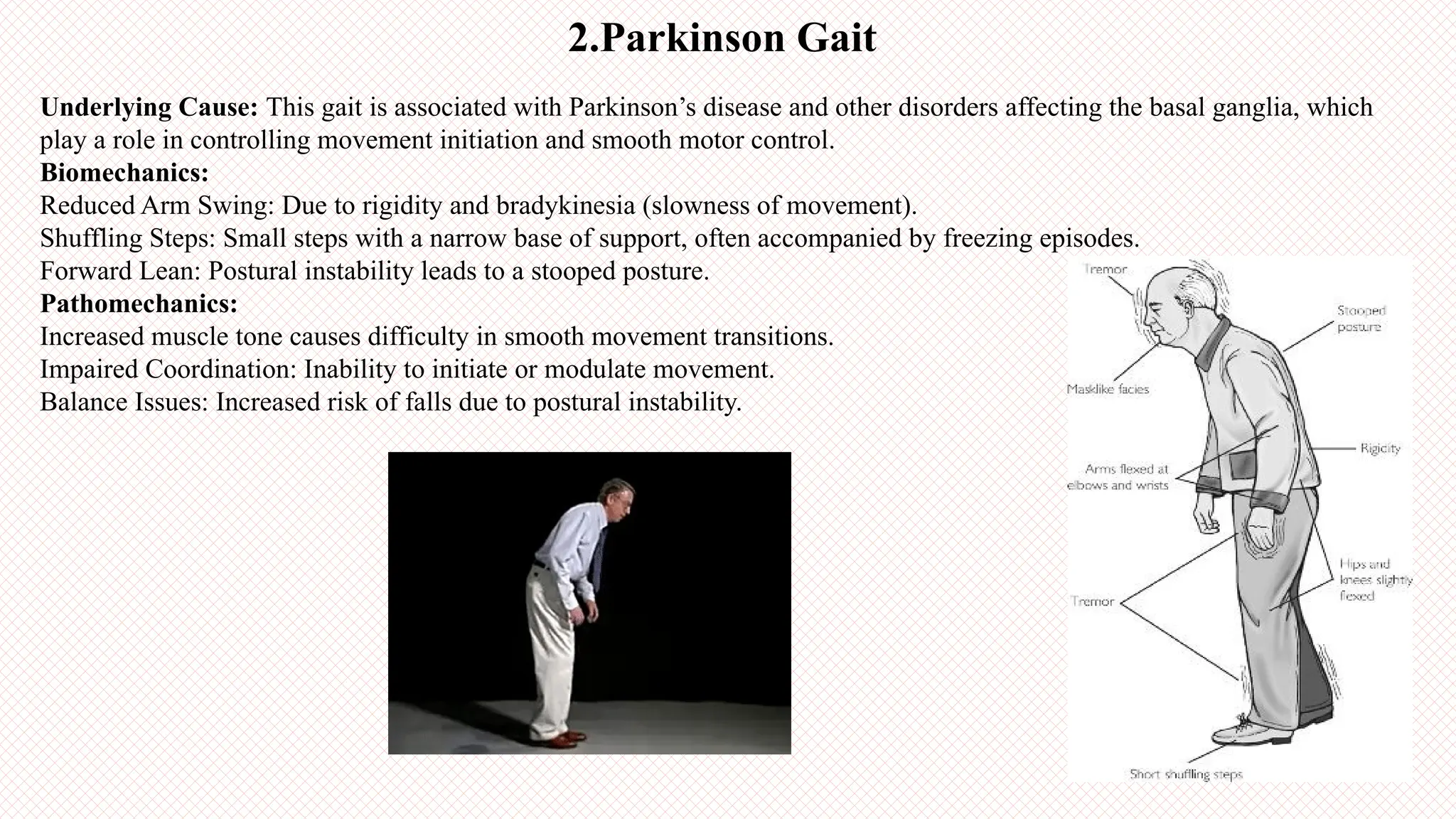 Abnormal Gait Pattern :Types and Causes. | PPTX