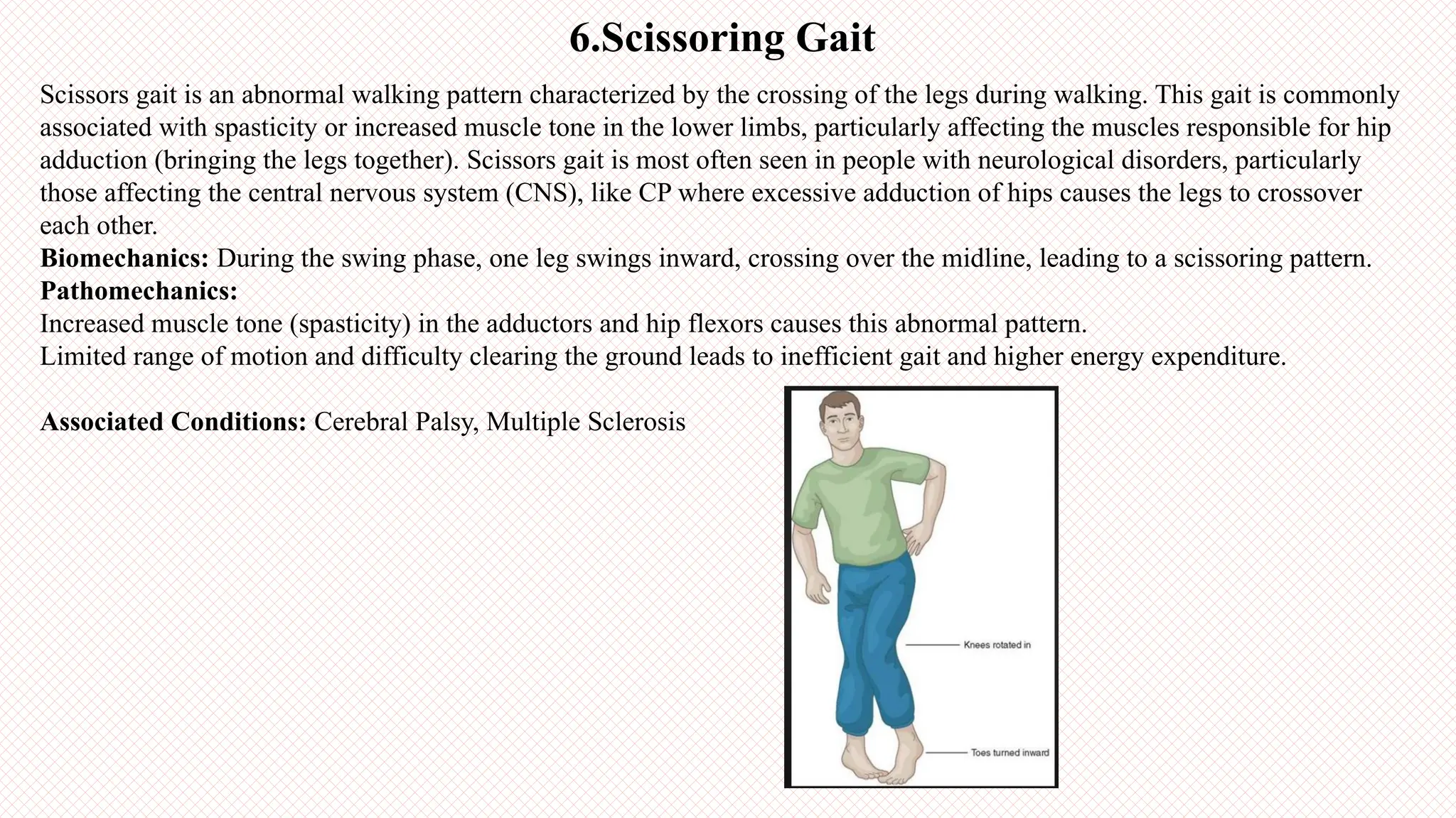 Abnormal Gait Pattern :Types and Causes. | PPTX
