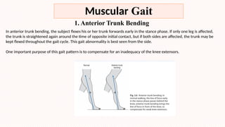 Abnormal Gait Pattern :Types and Causes. | PPTX
