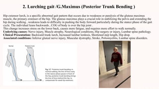 Abnormal Gait Pattern :Types and Causes. | PPTX