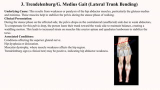 Abnormal Gait Pattern :Types and Causes. | PPTX