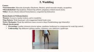 Abnormal Gait Pattern :Types and Causes. | PPTX