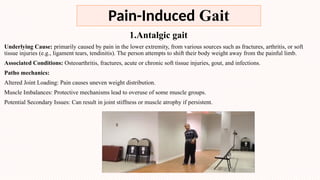 Abnormal Gait Pattern :Types and Causes. | PPTX