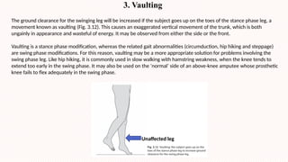 Abnormal Gait Pattern :Types and Causes. | PPTX