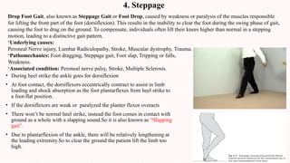 Abnormal Gait Pattern :Types and Causes. | PPTX