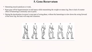 Abnormal Gait Pattern :Types and Causes. | PPTX