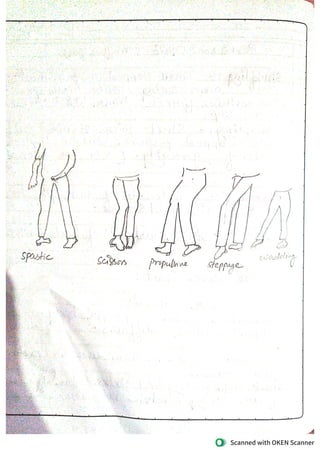 ABNORMAL GAIT PATTERNS ( SANA S wåri BPT 2nd yr ,kmch ) PPT-1.pdf ...