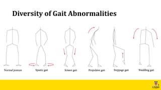 Abnormal Gait Recognition in Real-Time using Recurrent Neural Networks.pdf | Technology & Computing