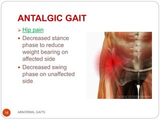 ABNORMAL GAITS IN NEUROLOGICAL CONDITIONS.pptx