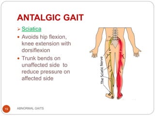 ABNORMAL GAITS IN NEUROLOGICAL CONDITIONS.pptx