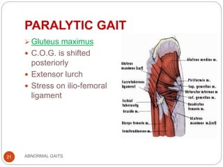 ABNORMAL GAITS IN NEUROLOGICAL CONDITIONS.pptx