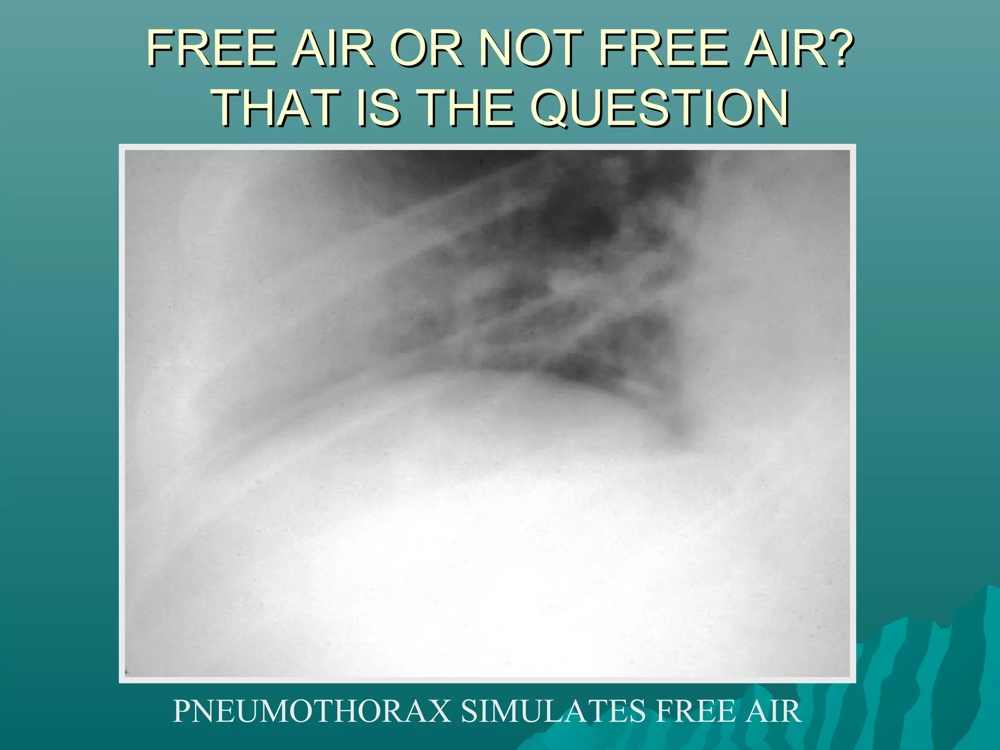 Abnormal gas | PPT | Lung and Respiratory Health | Diseases and Conditions