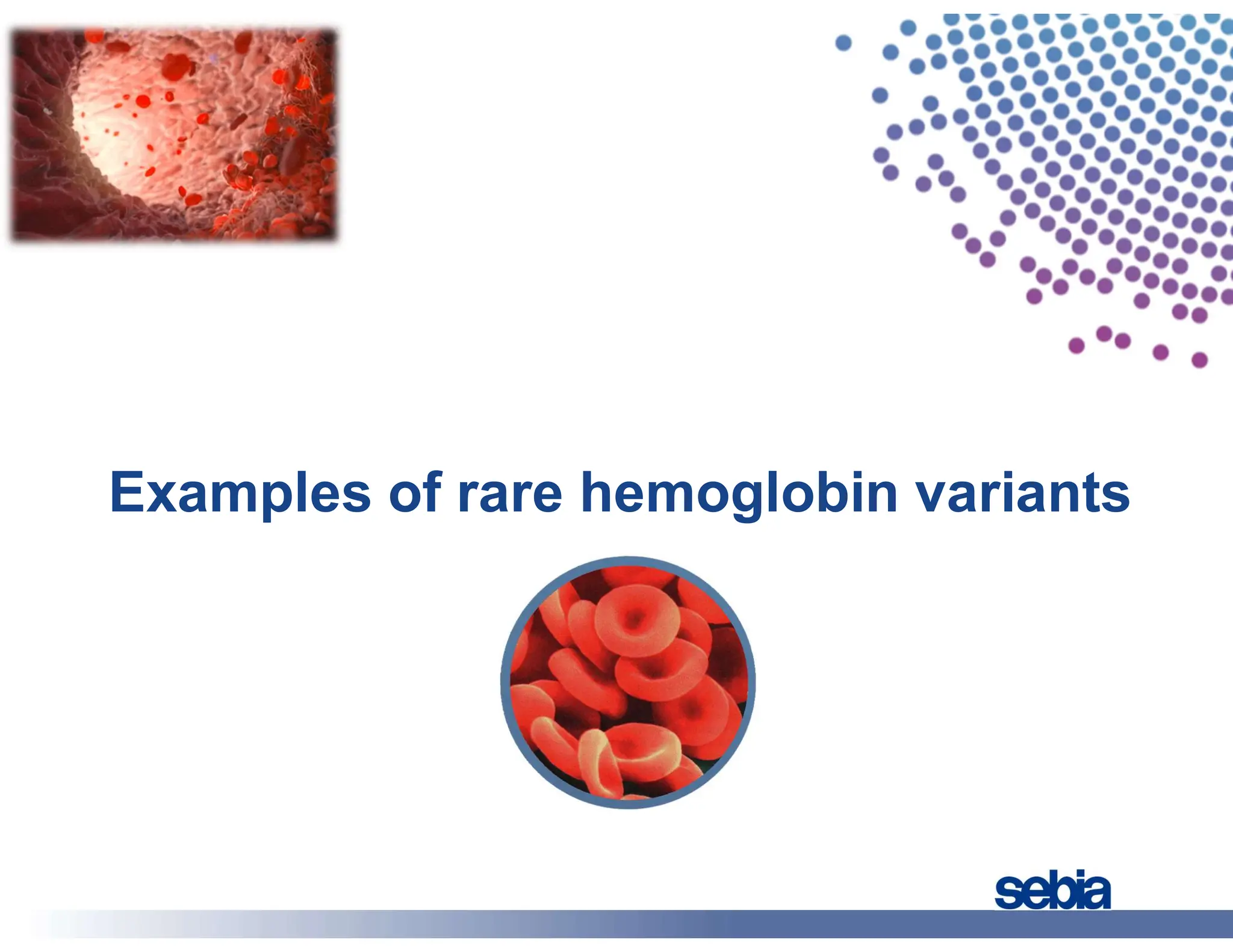 Rare Abnormal Hemoglobin Variants - Biochemistry | PDF