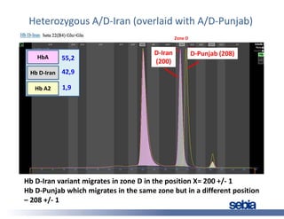 Rare Abnormal Hemoglobin Variants - Biochemistry | PDF