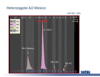 Rare Abnormal Hemoglobin Variants - Biochemistry | PDF