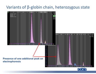 Rare Abnormal Hemoglobin Variants - Biochemistry | PDF