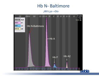 Rare Abnormal Hemoglobin Variants - Biochemistry | PDF