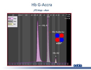 Rare Abnormal Hemoglobin Variants - Biochemistry | PDF