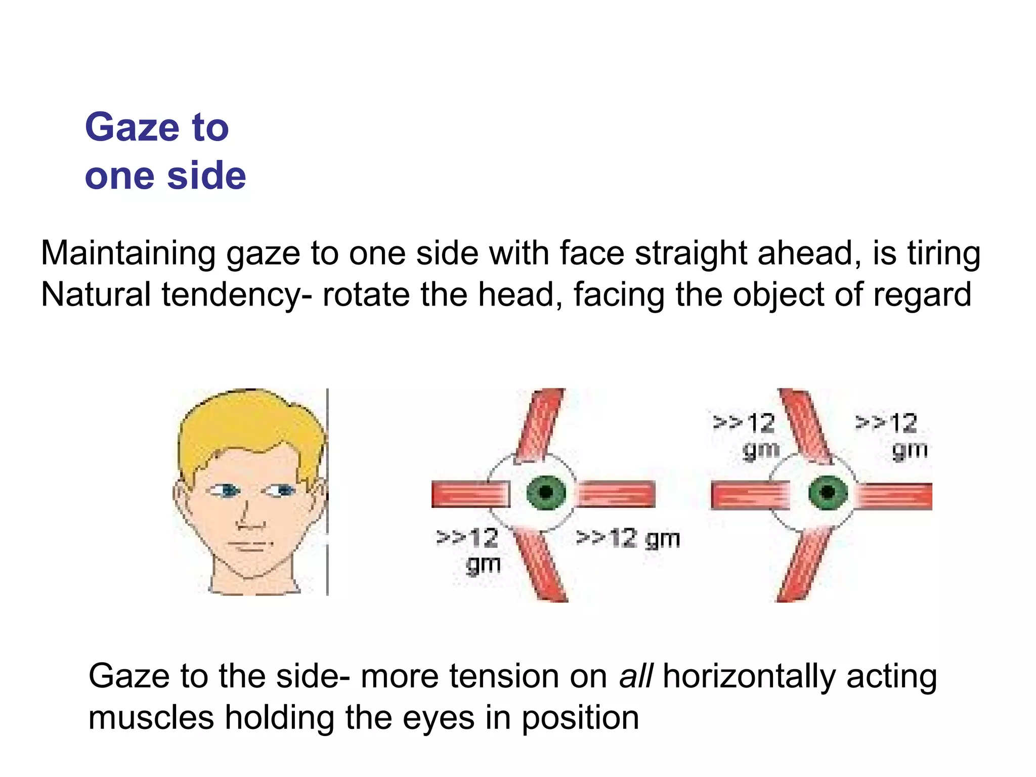 Abnormal Head Posture in squint | PPT