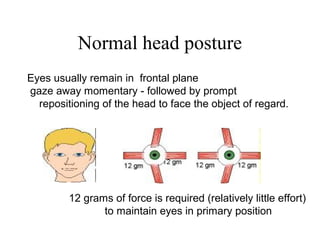 Abnormal Head Posture in squint | PPT