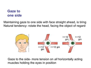 Abnormal Head Posture in squint | PPT
