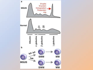 Abnormal immunoglobulins and immunoglobulin specificities (1) | PPTX