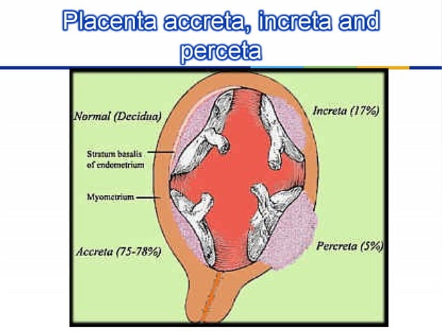 Abnormalities of-placenta-and-cordppt | PPT | Pregnancy | Reproductive Health