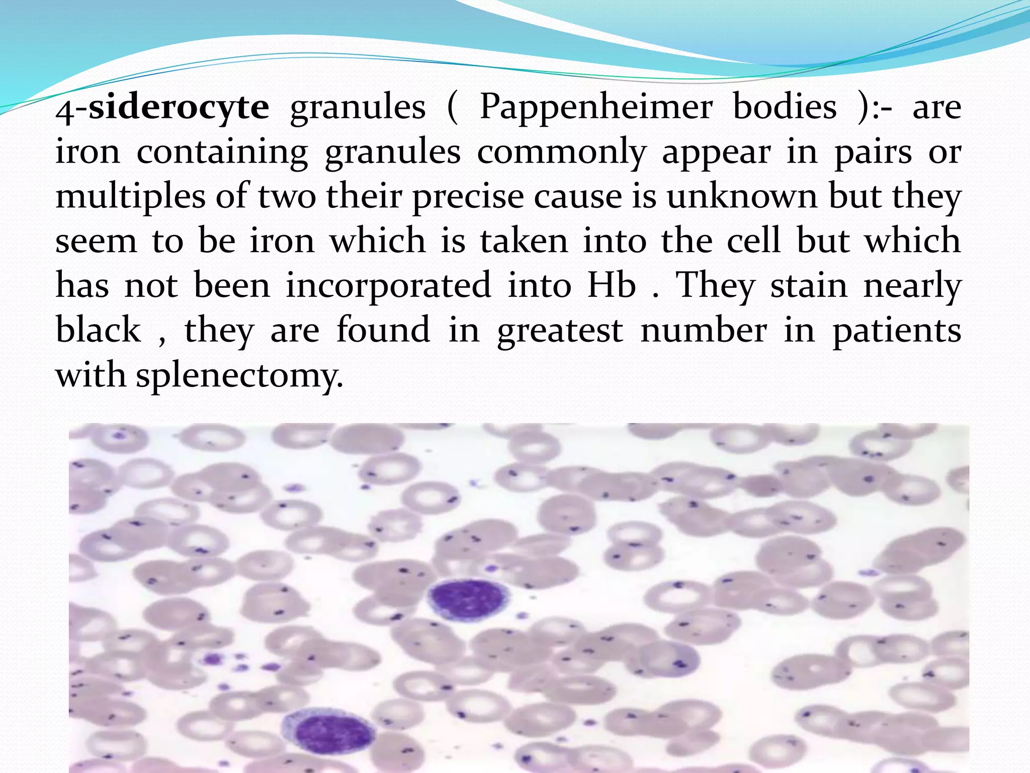 Abnormalities in color of RBCs | PPT