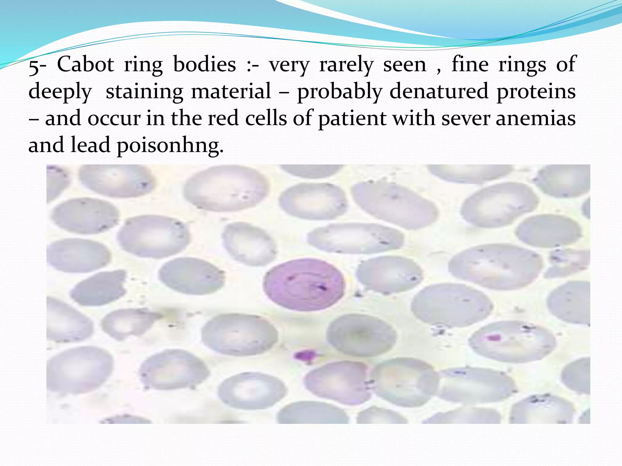 Abnormalities in color of RBCs | PPT
