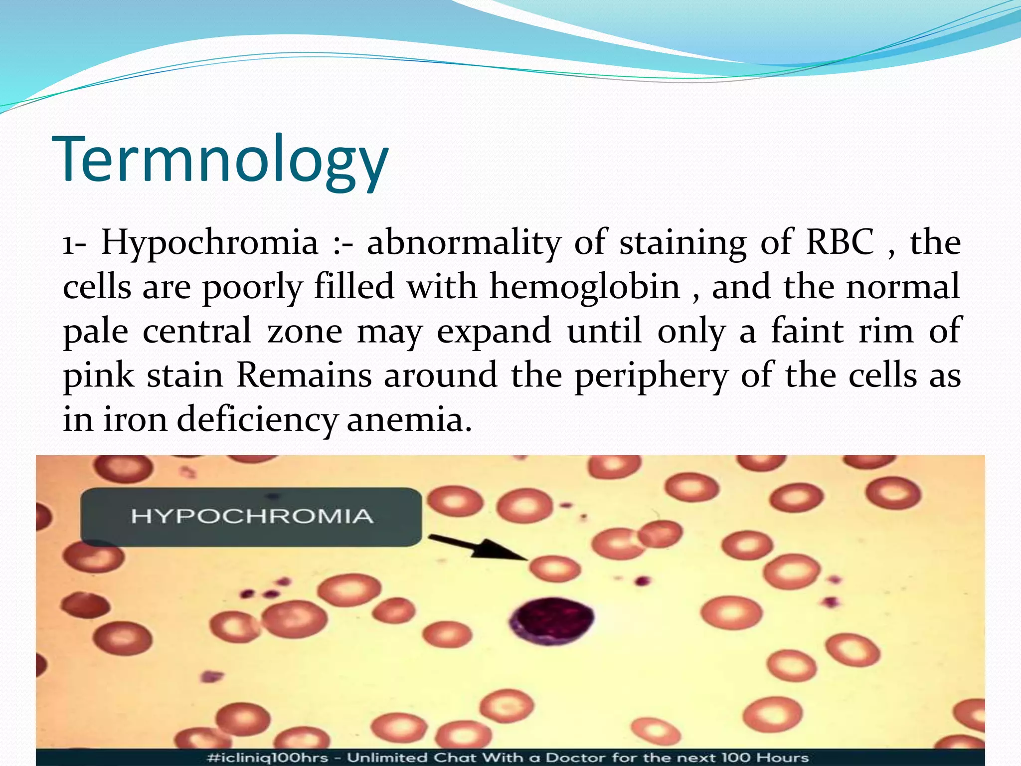 Abnormalities in color of RBCs | PPTX