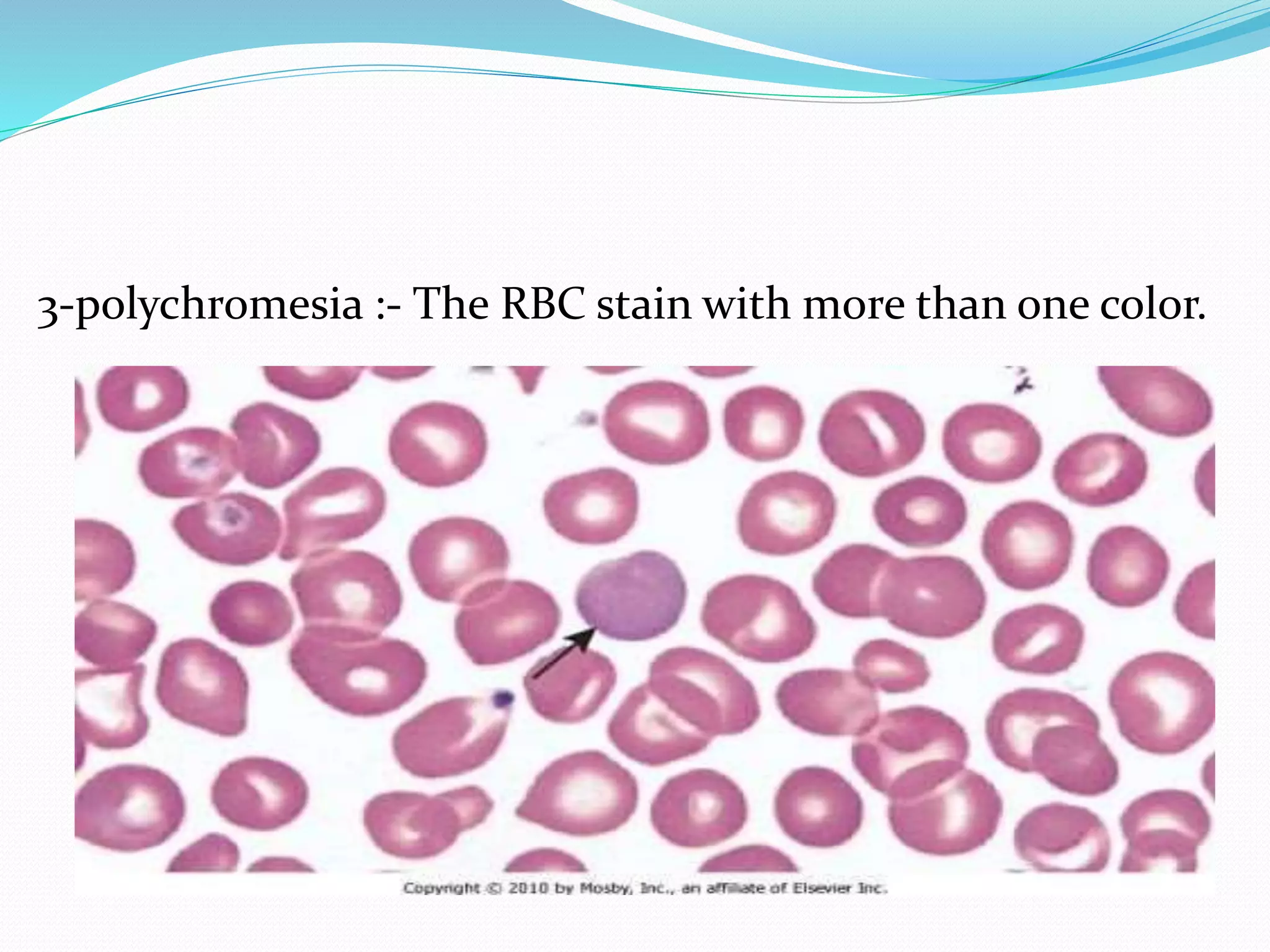 Abnormalities in color of RBCs | PPT