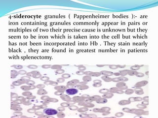 Abnormalities in color of RBCs | PPT | Free Download