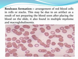 Abnormalities in color of RBCs | PPT | Free Download