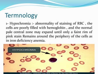 Abnormalities in color of RBCs | PPT | Free Download