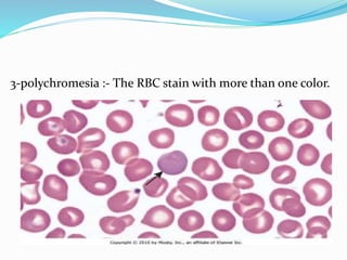 Abnormalities in color of RBCs | PPT | Free Download