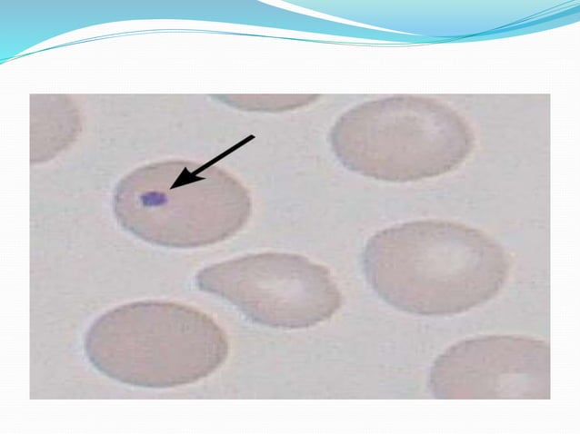 Abnormalities in color of RBCs | PPT