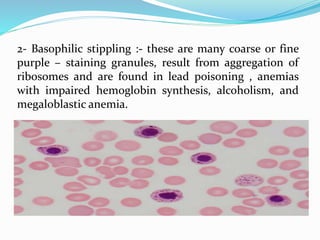 Abnormalities in color of RBCs | PPT | Free Download