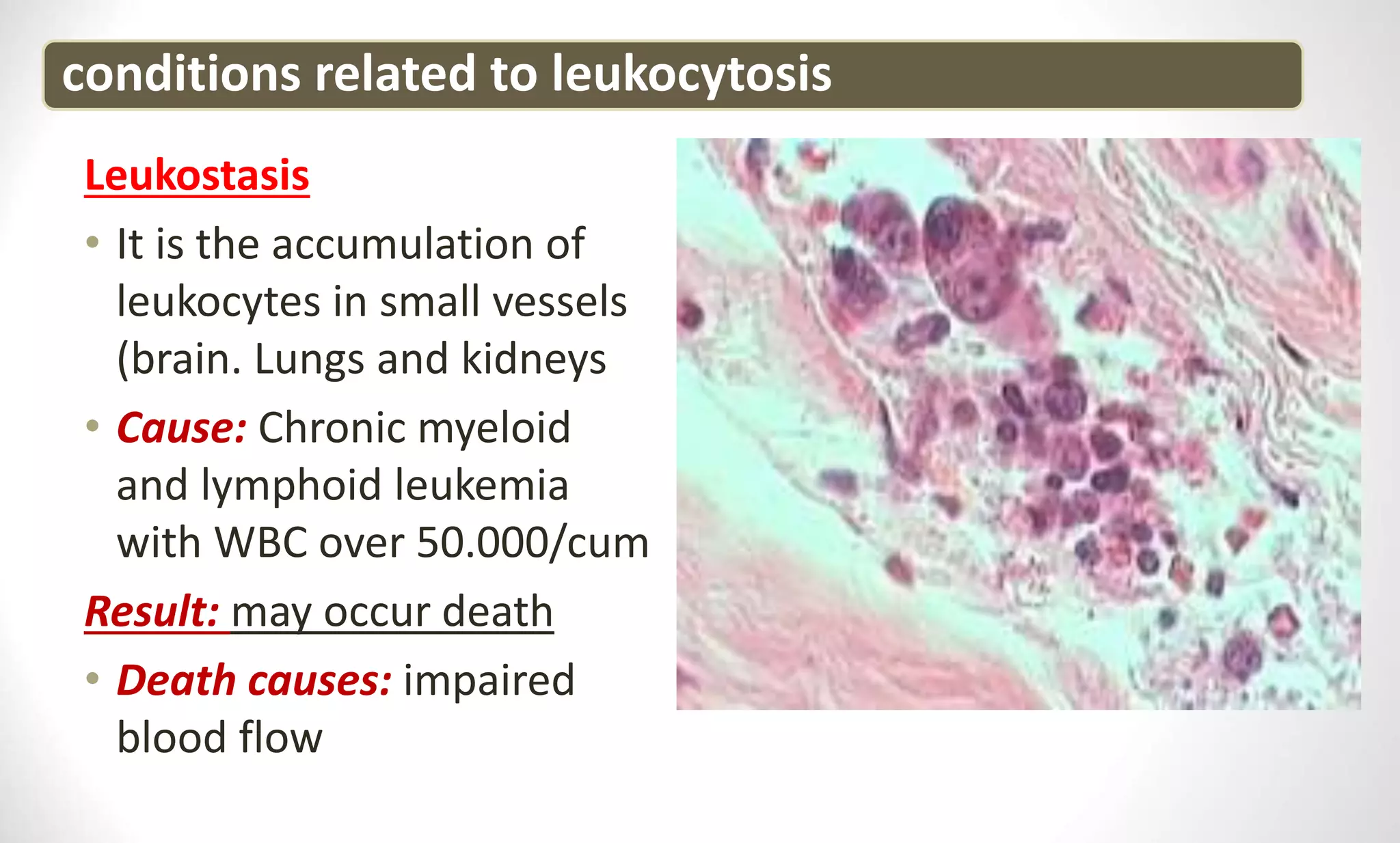 Abnormalities in leukocyte number.ppt