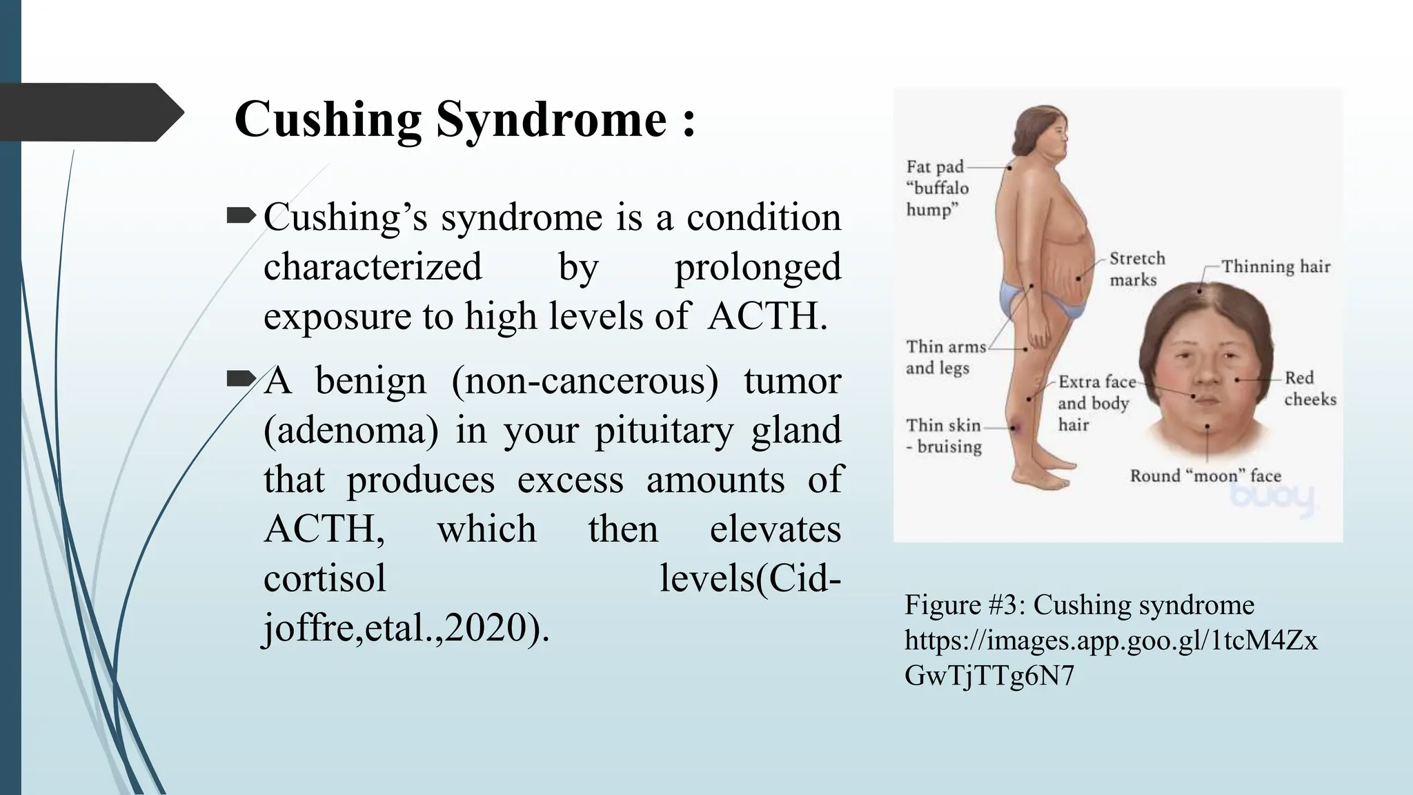 abnormalities of ACTH.pptx