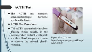 abnormalities of ACTH.pptx | Hormonal Disorders | Endocrine and ...