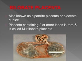 Placenta Duplex
