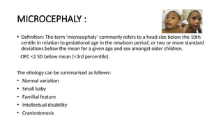 ABNORMALITIES OF HEAD SIZE AND SHAPE.pptx