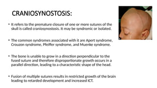 ABNORMALITIES OF HEAD SIZE AND SHAPE.pptx